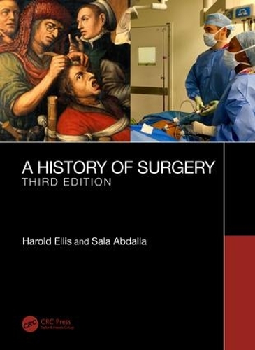 History of Surgery - UK) Guy's Hospital London Applied Biomedical ...