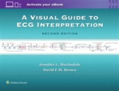 A Visual Guide to ECG Interpretation - Martindale