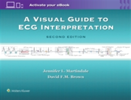 A Visual Guide to ECG Interpretation - Martindale
